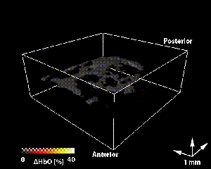 Neural Interface Engineering Lab