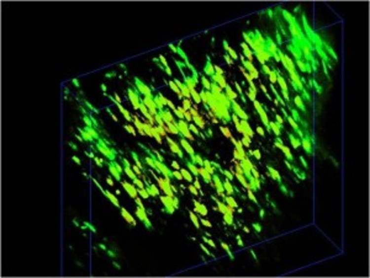 Cellular-resolution neurophotonics – Neural Interface Engineering Lab