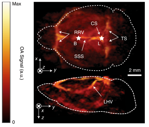 Mesoscopic neural interfaces – Neural Interface Engineering Lab